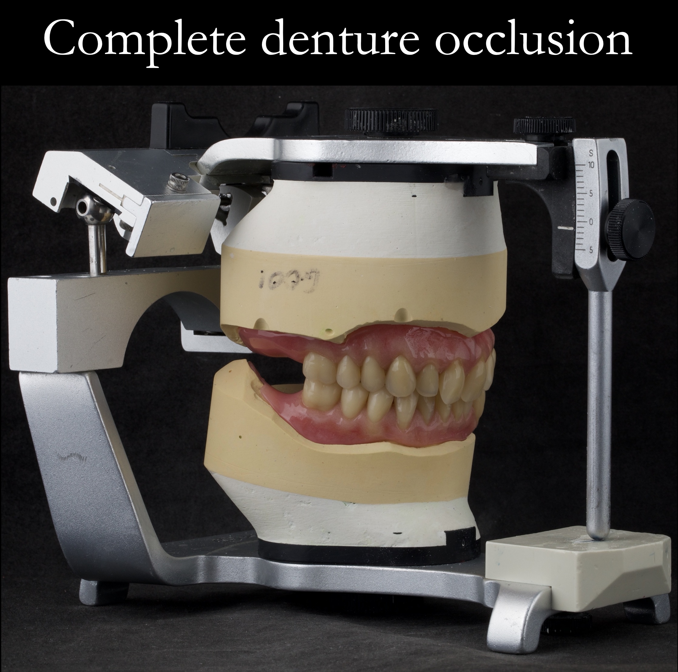 Complete denture occlusion – the essentials | Finlay Sutton - Denture ...