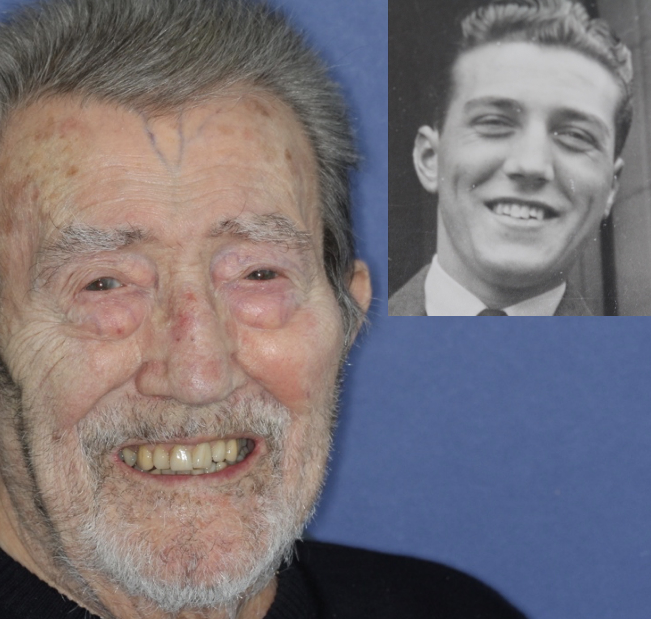 Be brave with your tooth positioning | Finlay Sutton - Denture Education