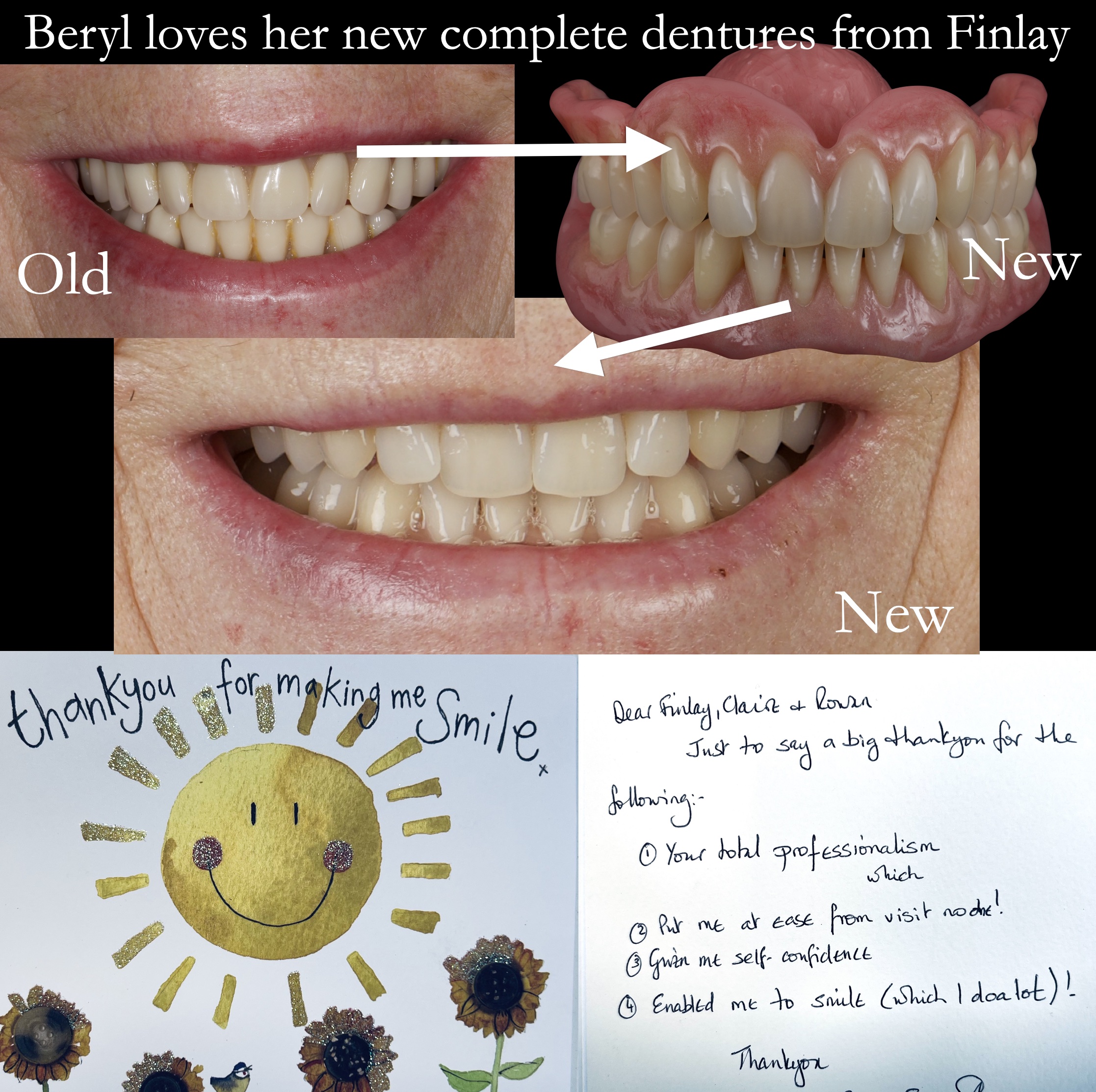 Beryl loves her new complete dentures from Finlay | Finlay Sutton ...