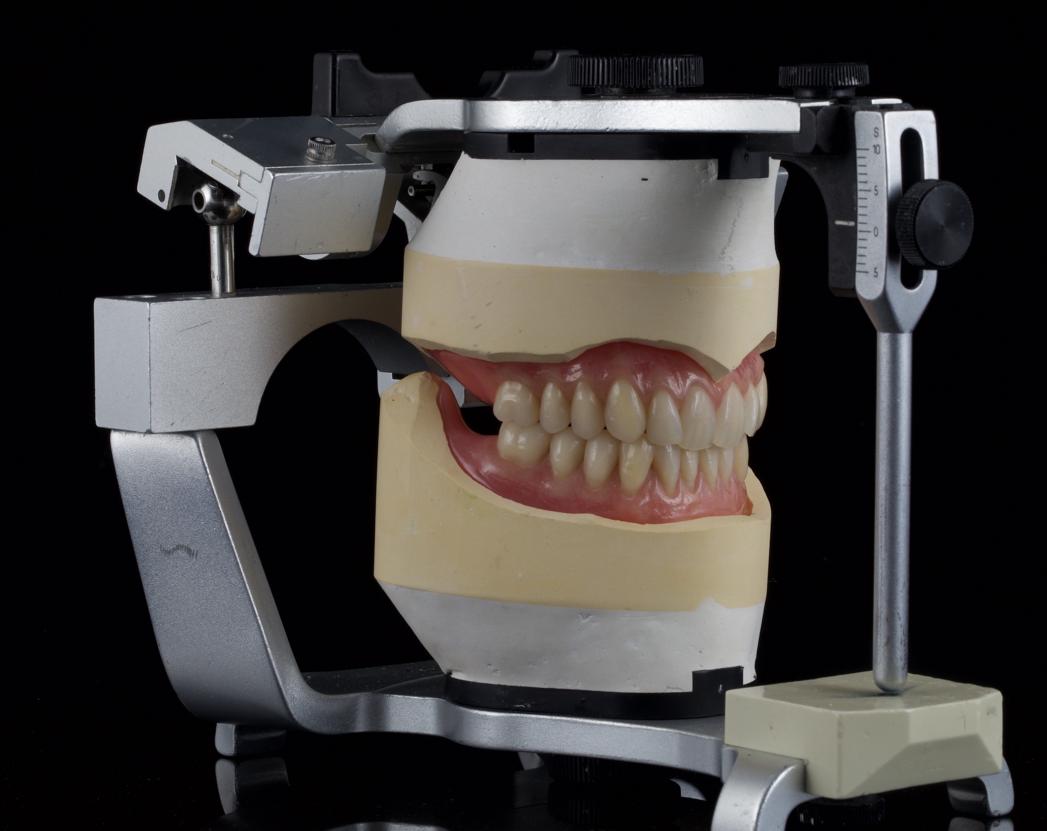 Beryl loves her new complete dentures from Finlay | Finlay Sutton ...